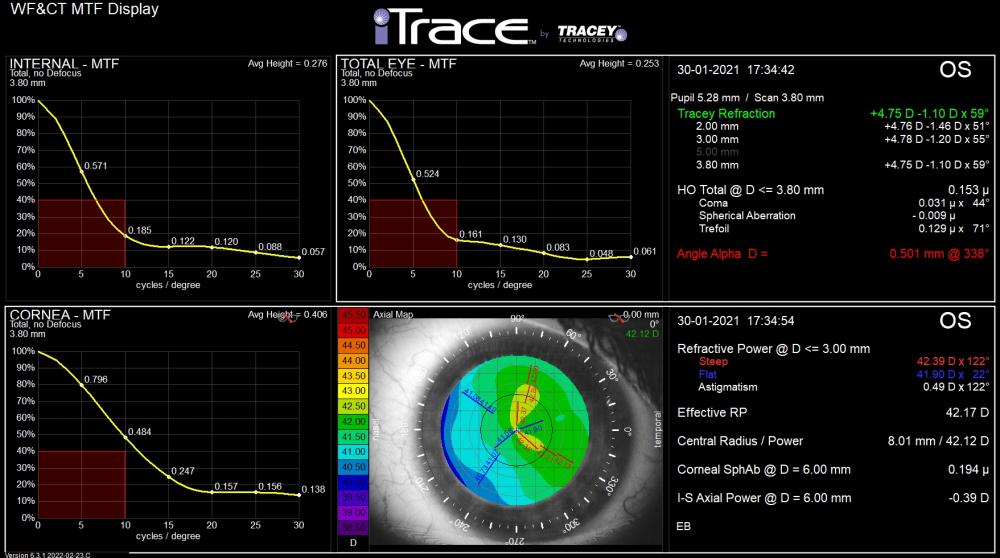 iTRACE™ | Tracey Technologies | Produkt