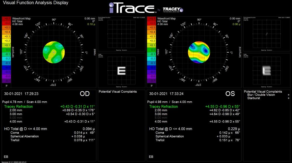 iTRACE™ | Tracey Technologies | Produkt